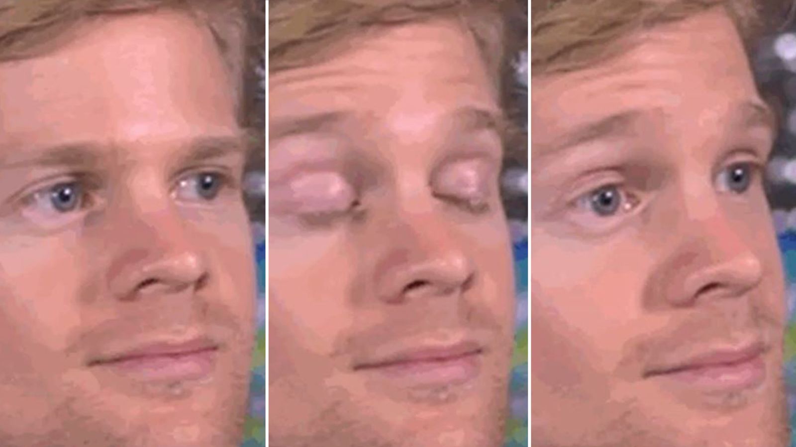 Blinking Guy Needs Your Help to Fund MS Research