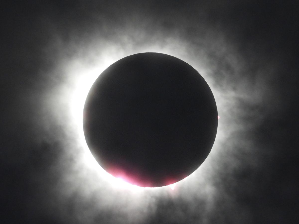 Google Searches For ‘My Eyes Hurt’ Spike After Solar Eclipse