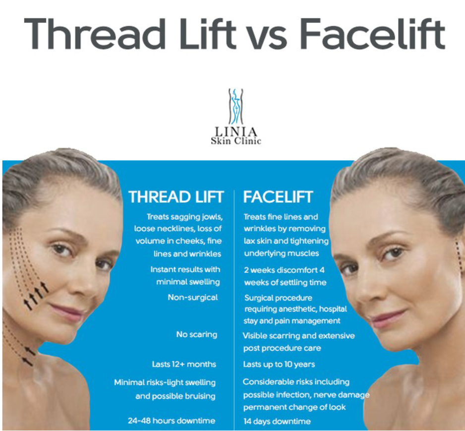 Thread Lift Treatment: A Non-Surgical Facelift Option
