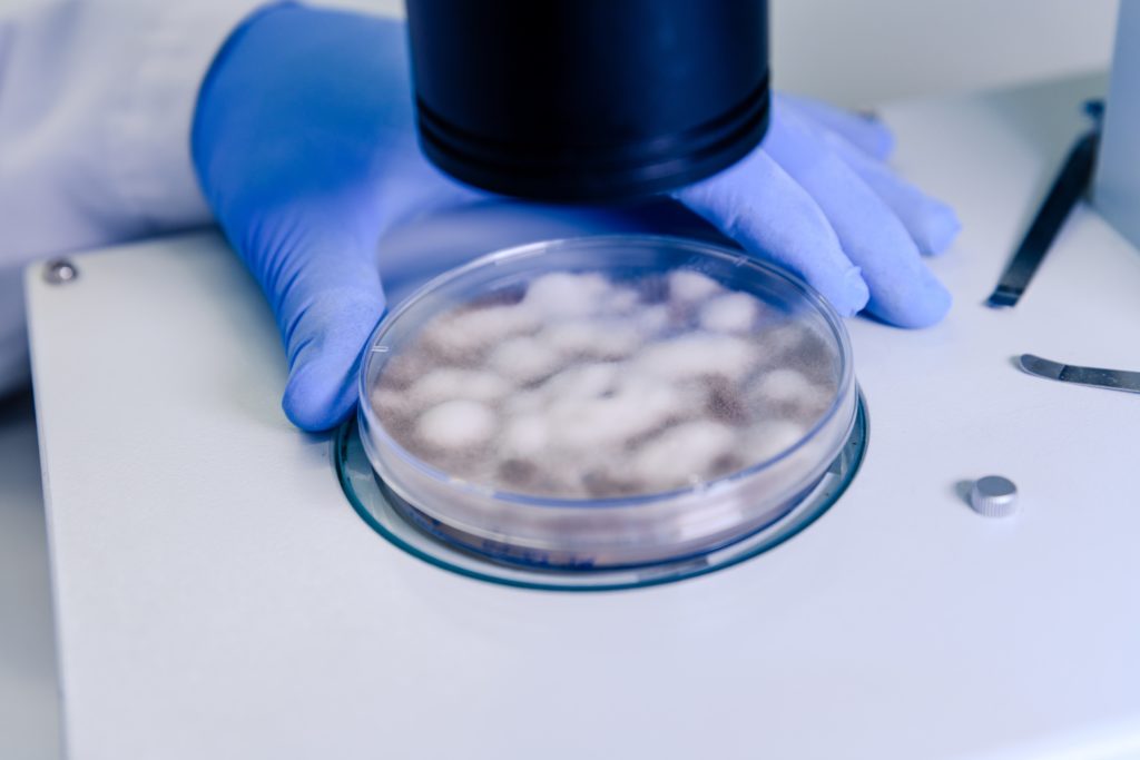 The LUNA-STEM: Specialized Cell Counting for Stem Cell and Sensitive ...